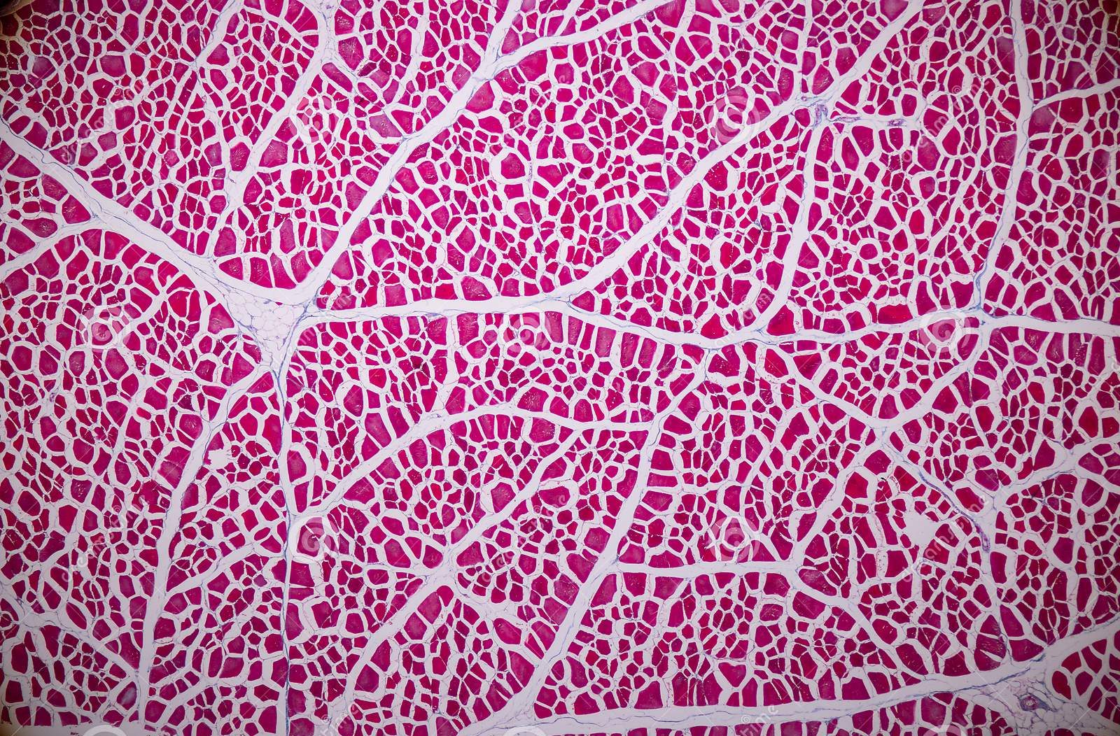 Tissue Tolerance: The Key to Injury Prevention